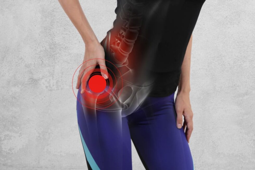 Caminar con bursitis de cadera | Fisioterapia Lepol